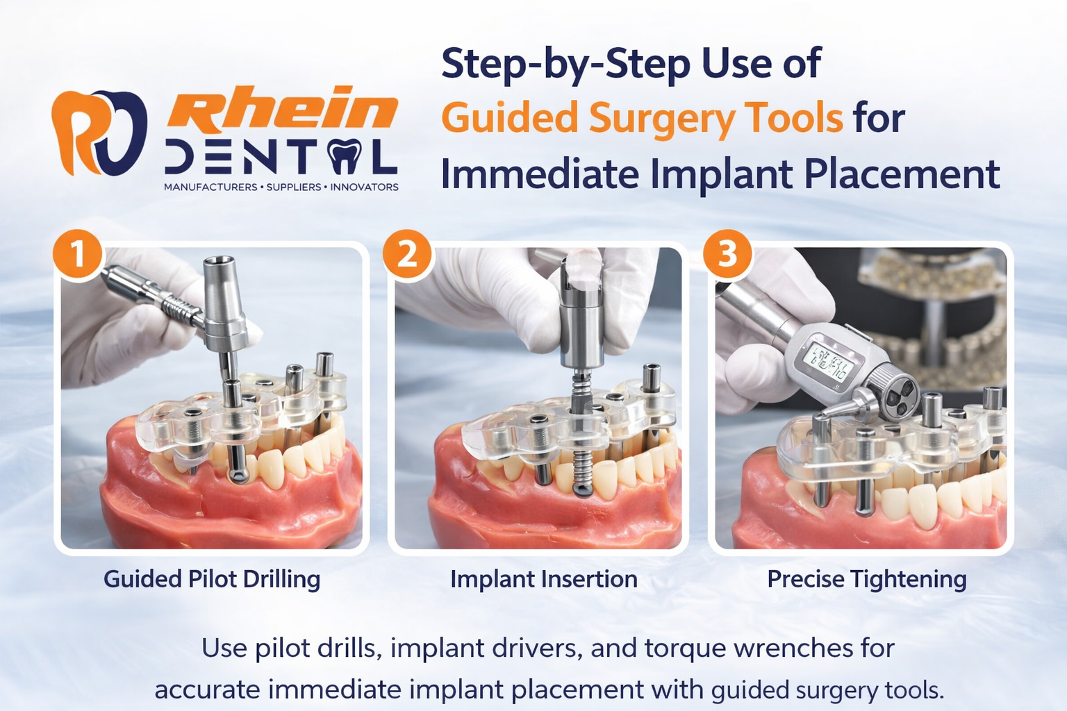 Step-by-Step Guide to Implant Placement with Guided Surgery
